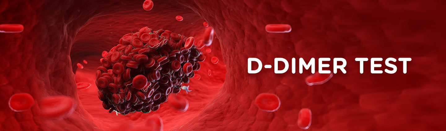 What Is a D-Dimer Test? Understand Its Importance and Uses